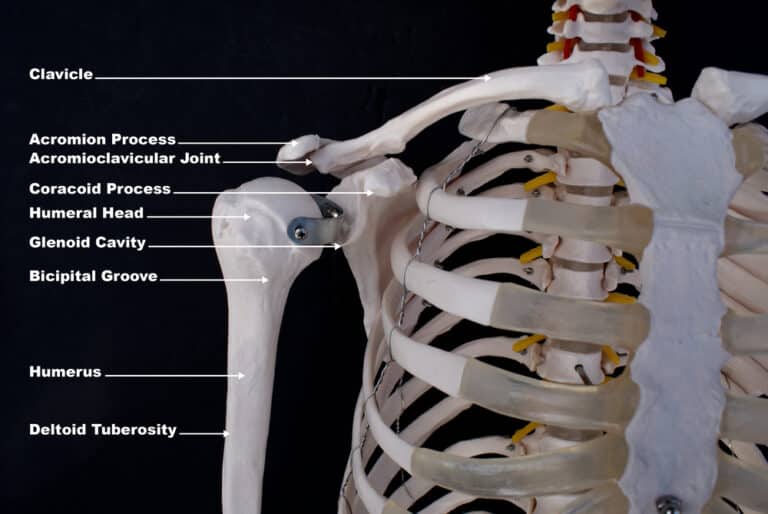 Shoulder Osteoarthritis (OA) - London Bridge Orthopaedics